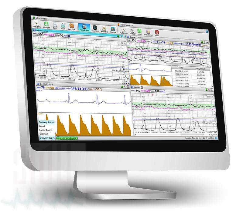 Edan MFM-CNS Lite Software zu CTG F3 | StollMT Shop